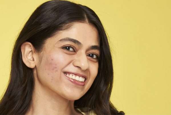 The Secret To Clear Skin: How To Use A Face Serum For Removing Dark ...